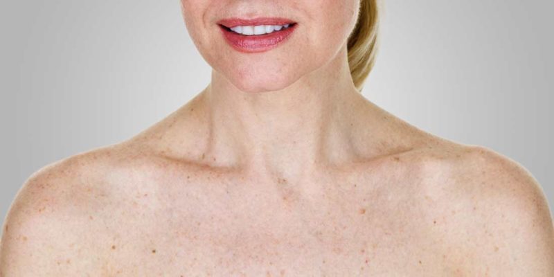 Taches brunes et laser - Docteur Fraissinet Médecine Esthétique